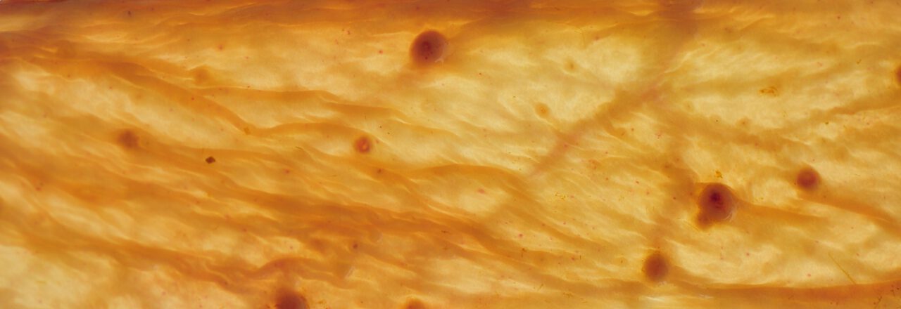 7 inzichten in de ingekapselde kleine bloedworm | FECtest & Mesttest.com